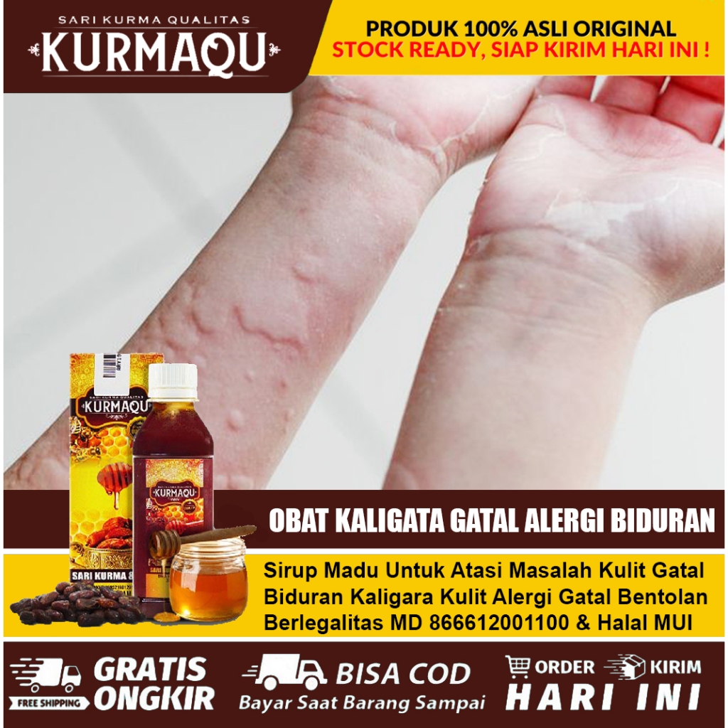 Jual Obat Kaligata, Obat Gatal Kulit Alergi, Alergi Dingin, Obat ...