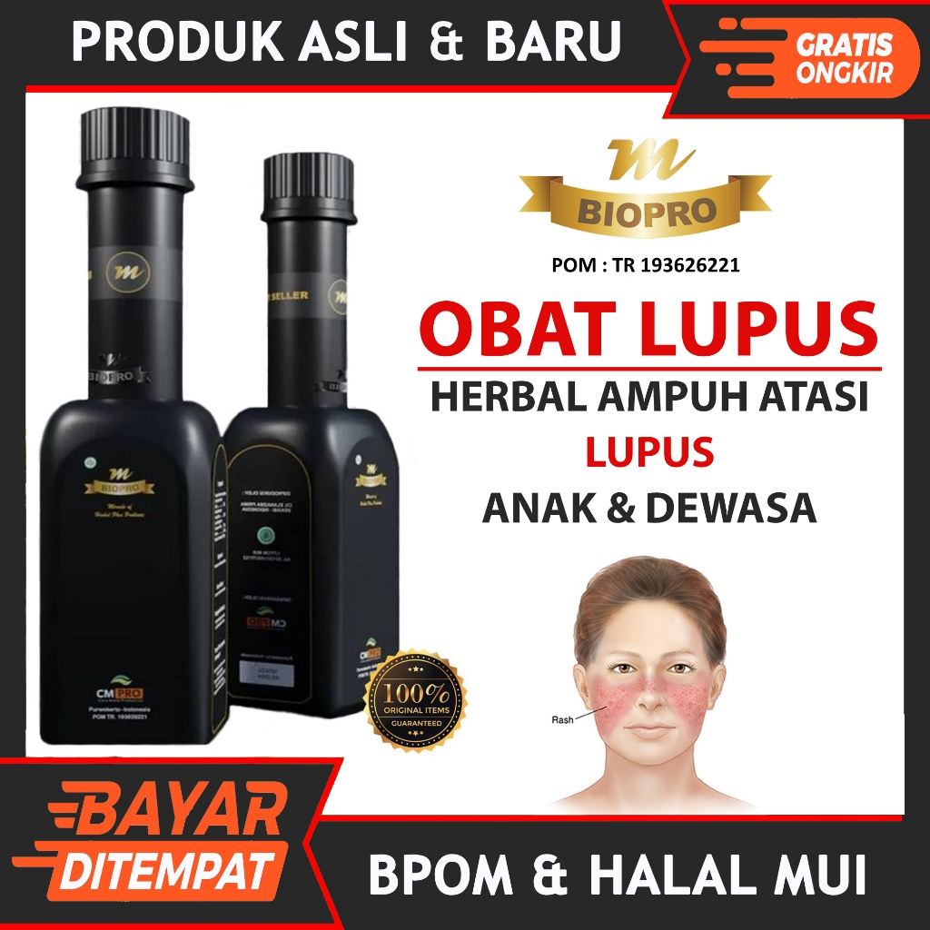 Jual Mbiopro Original - Obat Lupus Autoimun Kronis Paling Ampuh Untuk ...