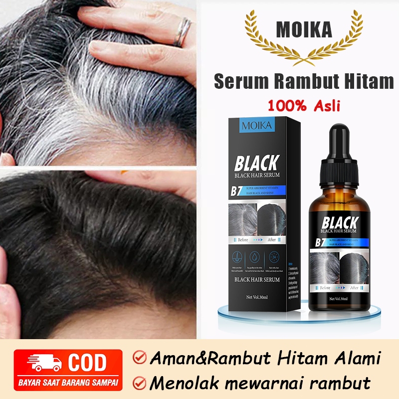 Jual ORI Penghitam Rambut Serum Penumbuh Rambut Cepat Bahan Herbal ...