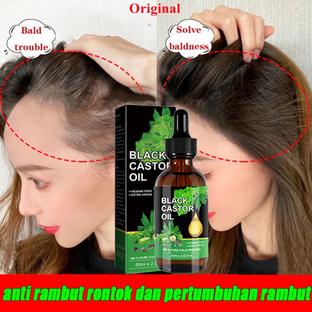Jual minyak jarak obat penumbuh rambut serum rambut rontok castor oil ...