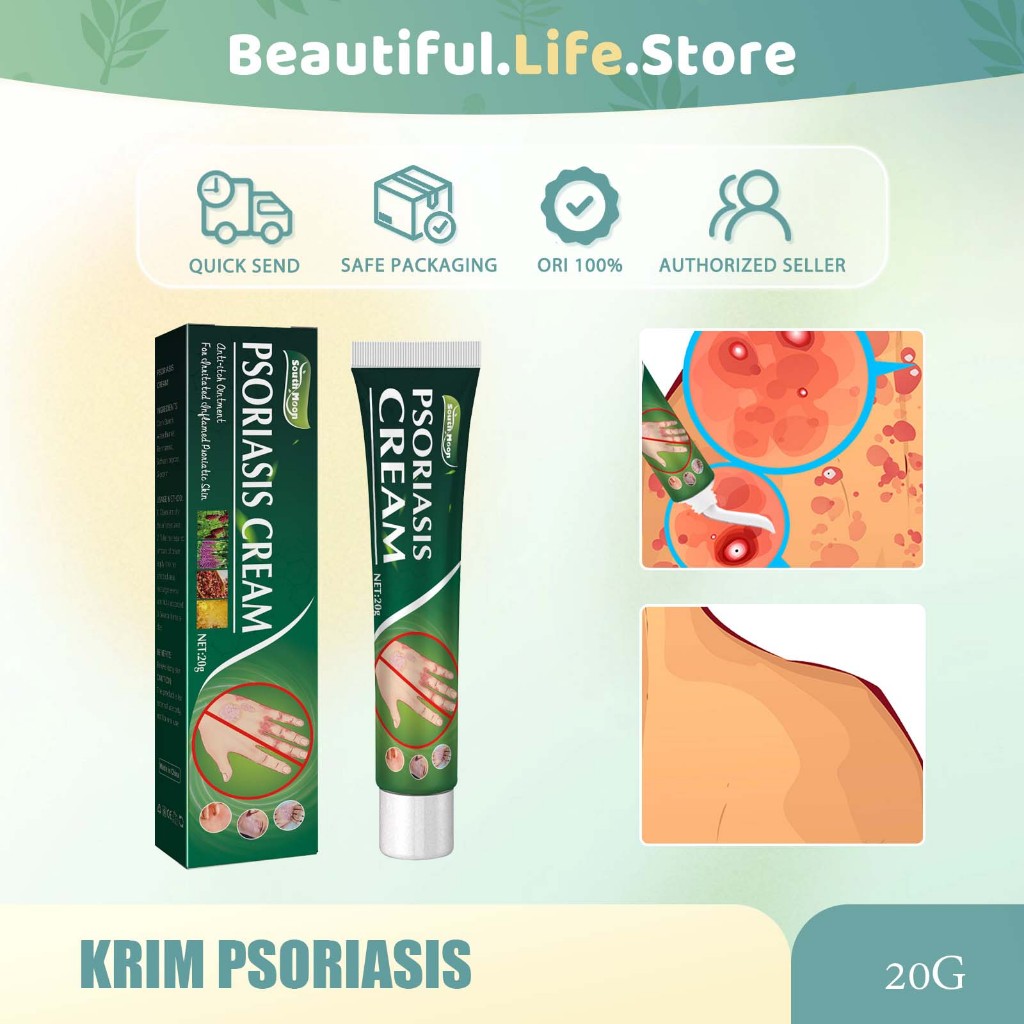 Jual SOUTH MOON Krim Psoriasis Salep Anti-Gatal Psoriasis Repair ...