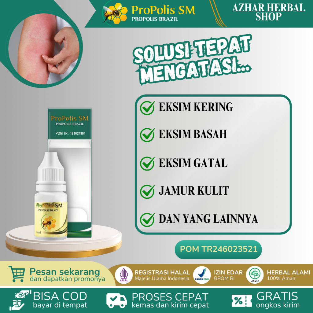 Jual Propolis SM Obat Eksim Kering Menahun, Obat Eksim Gatal, Obat ...