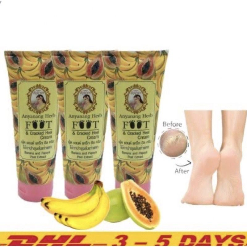 Jual Anyanang Herb Foot cracked heel | Shopee Indonesia