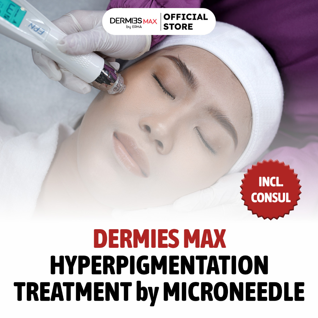 Jual Dermies Max Hyperpigmentation treatment by Microneedle | Shopee ...