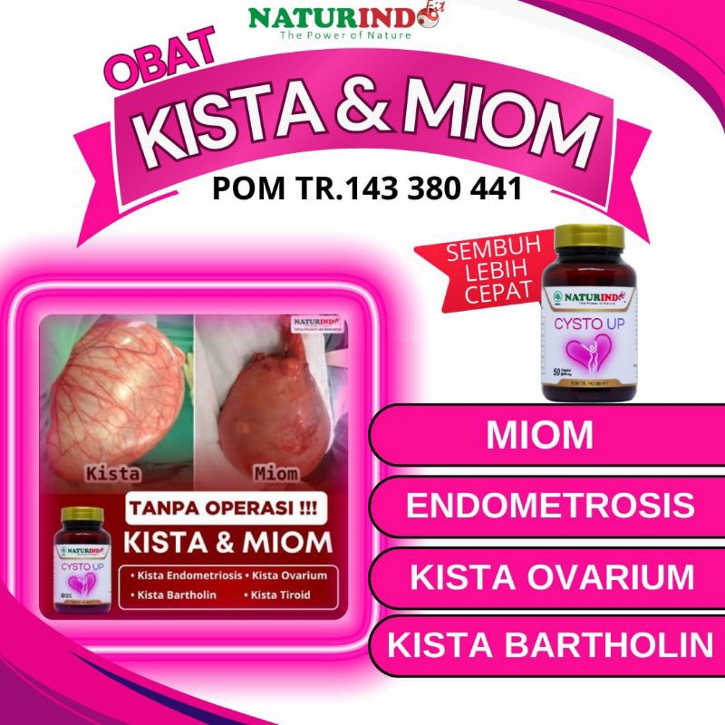 Jual Obat kista dan miom myom Herbal Coklat Kista endometriosis cysta ...