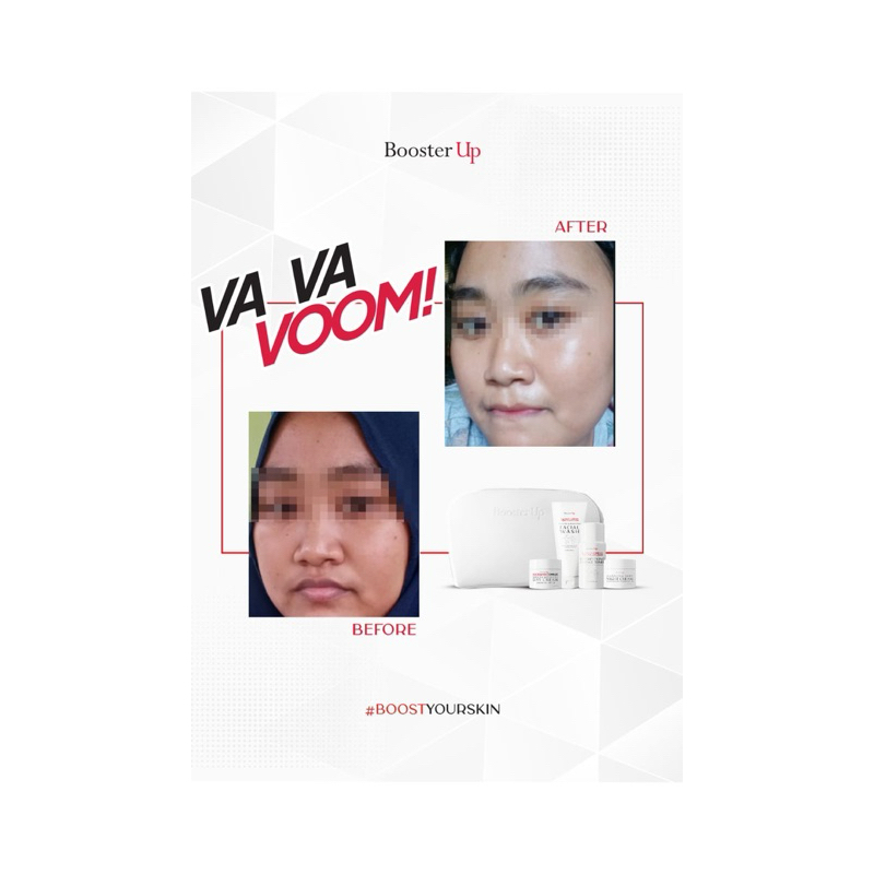 Jual BOOSTER UP SKINCARE DEPOK | Shopee Indonesia