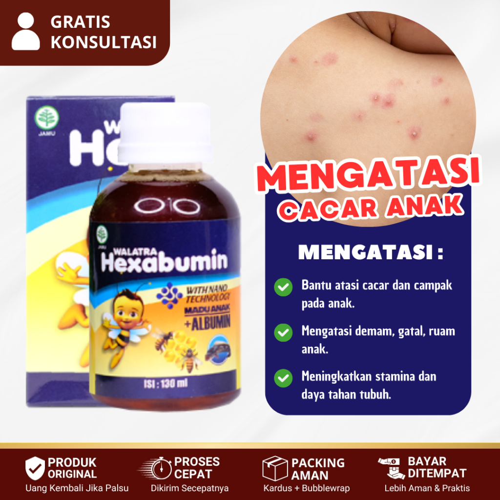 Jual Obat Cacar Anak 1 Sampai 12 Tahun, Obat Campak Anak, Anak Demam ...
