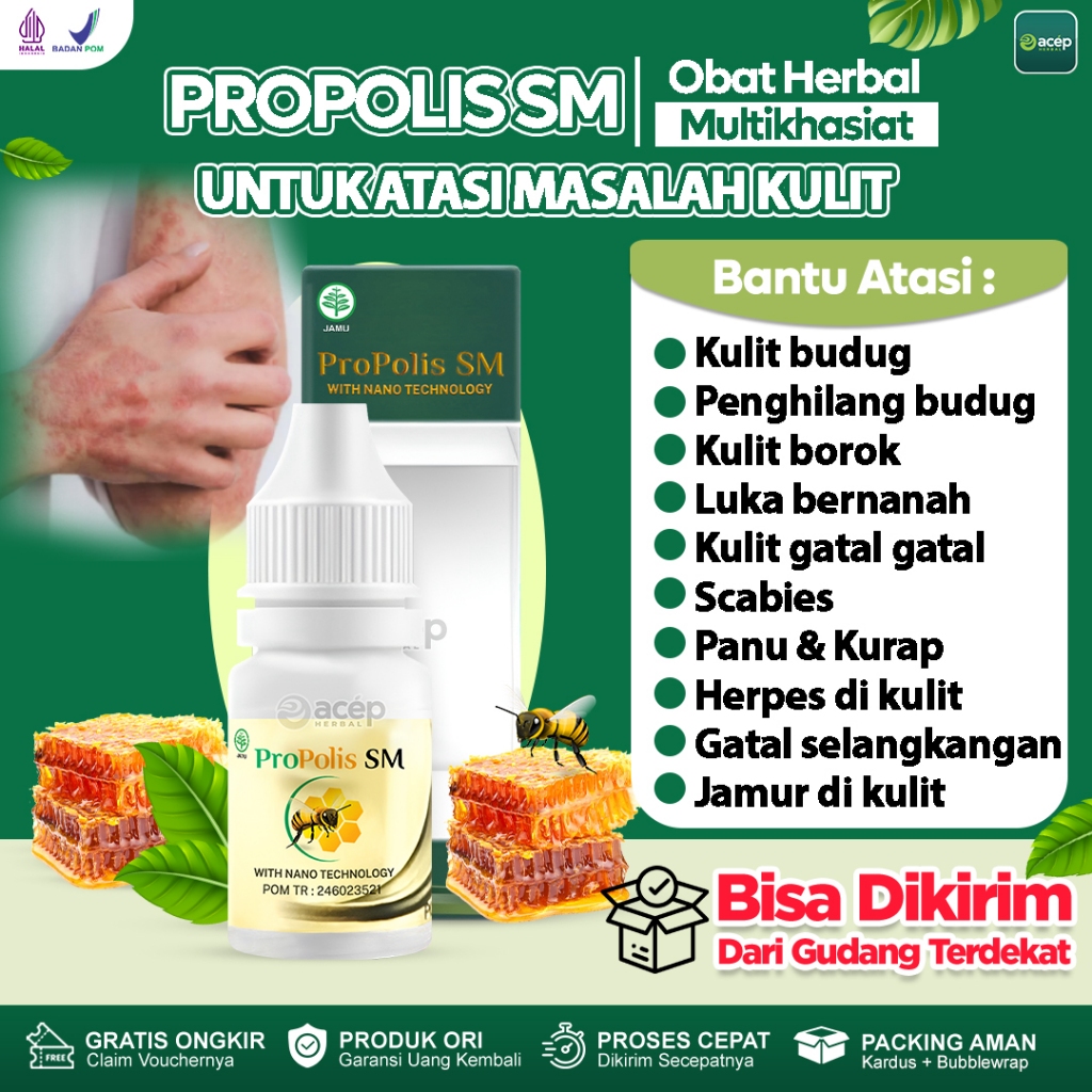 Jual Obat Budug Anak Dewasa Budug Bernanah Penghilang Bekas Budug Di ...