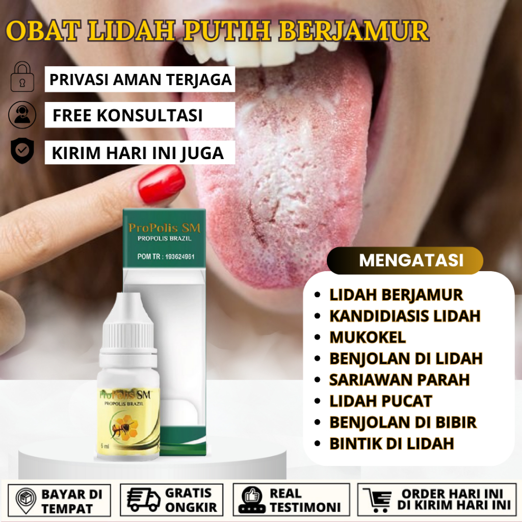 Jual Obat Lidah Putih Berjamur Pembersih Lidah Penghilang Bintik Putih ...