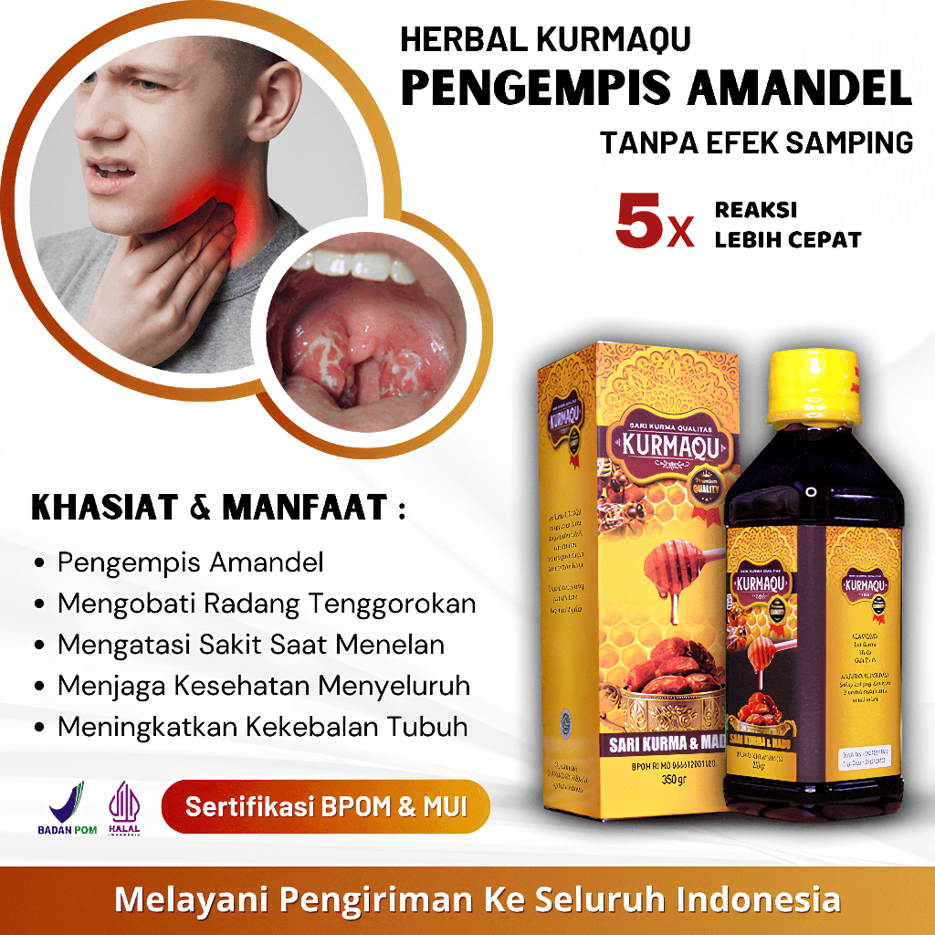 Jual Obat Amandel Untuk Anak Dan Dewasa Radang Tenggorokan Sakit Saat Menelan Herbal Madu ...