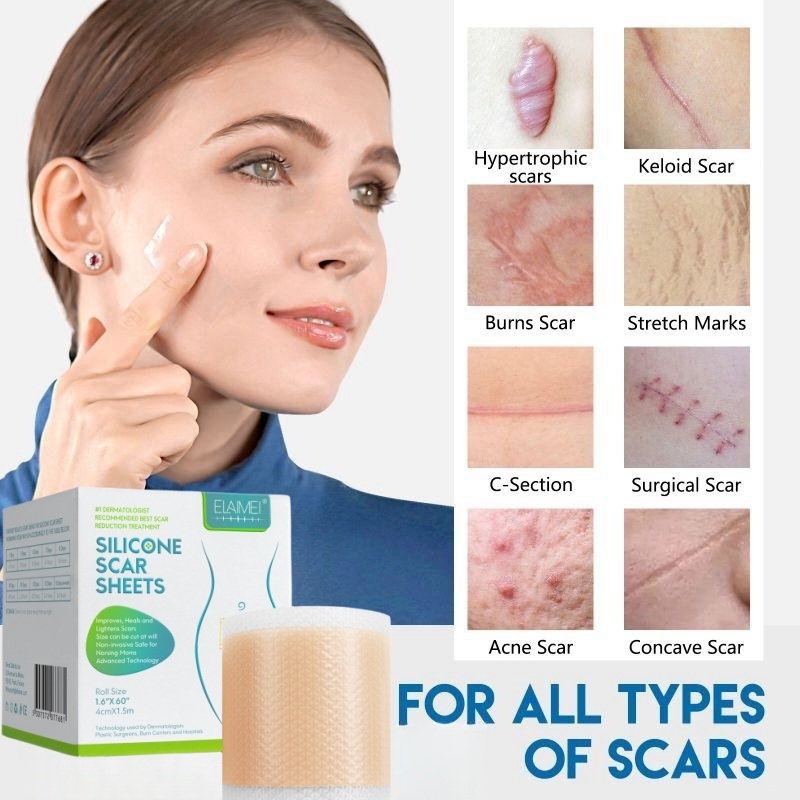 Jual 【COD ORI】ELAIMEI Silicone Scar Sheets Patch Penghilang Keloid ...