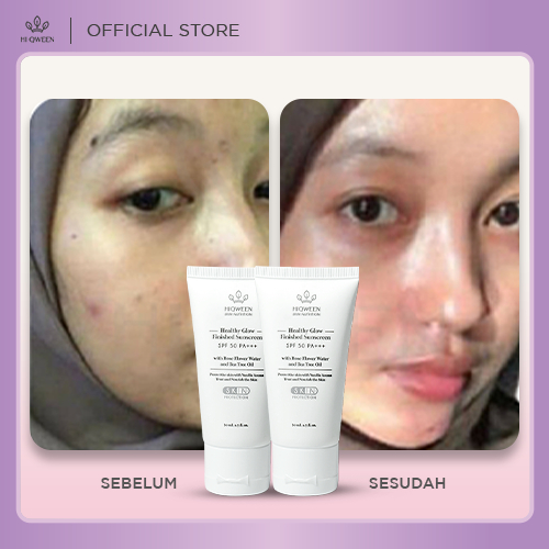 Jual HIQWEEN SURABAYA | TWINPACK Hiqween Sunscreen Suncreen Wajah SPF ...