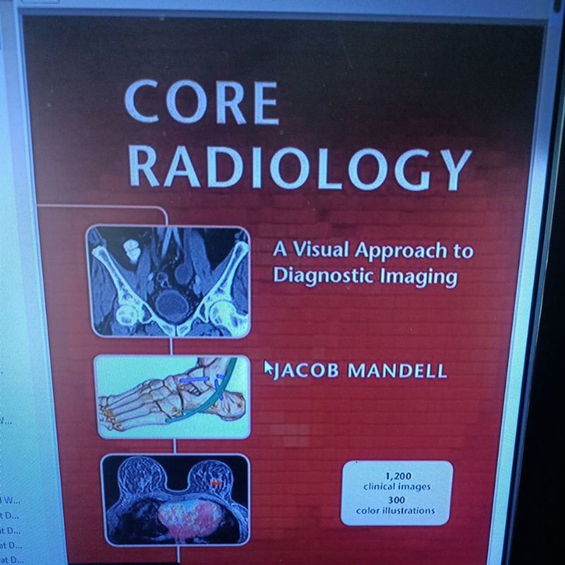 Jual core radiology Jacob mandell | Shopee Indonesia