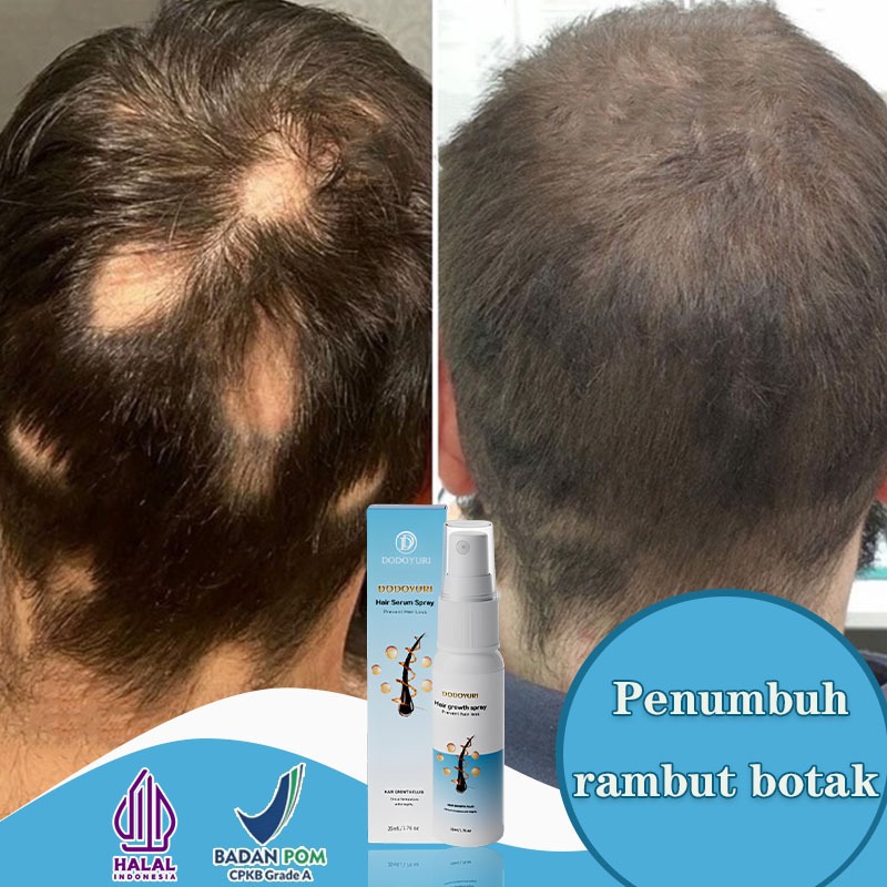 Jual (BPOM)Obat penumbuh rambut penumbuh rambut cepat serum penumbuh ...