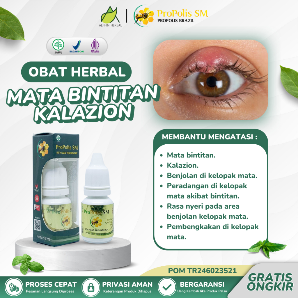 Jual Obat Bintitan Kalazion di Kelopak Mata Bengkak Benjolan Bintilan ...