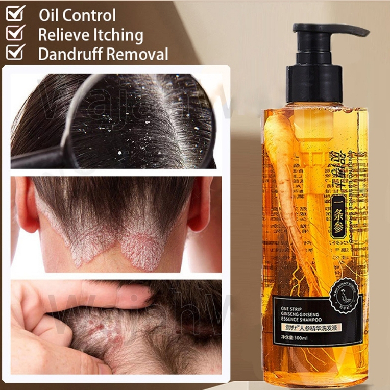 Jual Ginseng Shampo Anti Rontok Dan Anti Ketombe Sampo Anti Ketombe 100 ...
