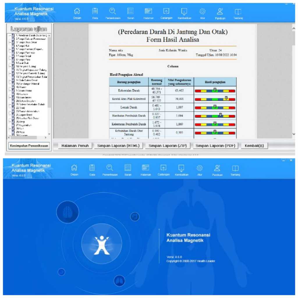 Jual SOFTWARE APLIKASI UNTUK ALAT QUANTUM RESONANCE MAGNETIK ANALYZER ...