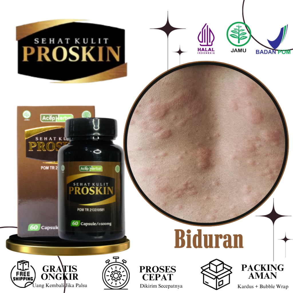 Jual Proskin - Obat Biduran Alergi Dingin Ruam Merah Kaligata Bentol ...