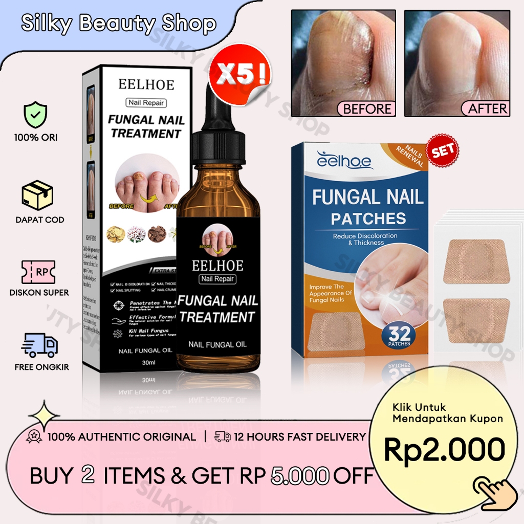Jual EELHOE 【5pcs】Obat Jamur Kuku Anti Jamur Perawatan Kuku Krim ...