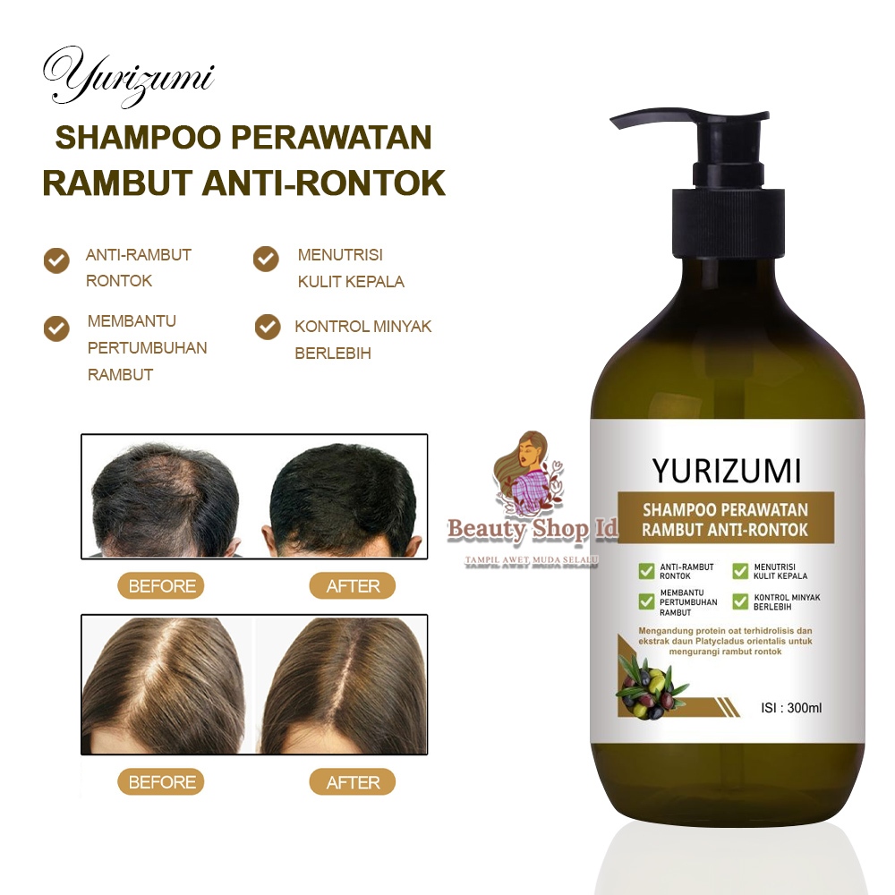 Jual Shampo Oil Control Sampo 300ml Anti Hair Fall Hair Treatment Anti Ketombe | Shopee Indonesia