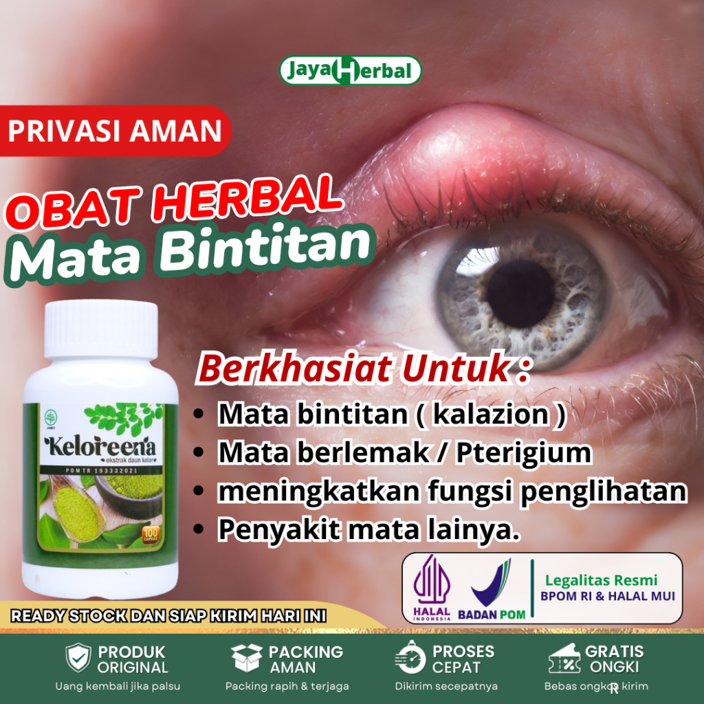 Jual Obat Mata Bintitan, Penghilang Benjolan di Kelopak Mata, Mata ...