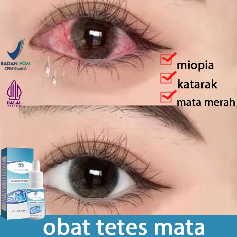Jual Obat mata minus obat mata katarak obat tetes mata pembersih mata ...