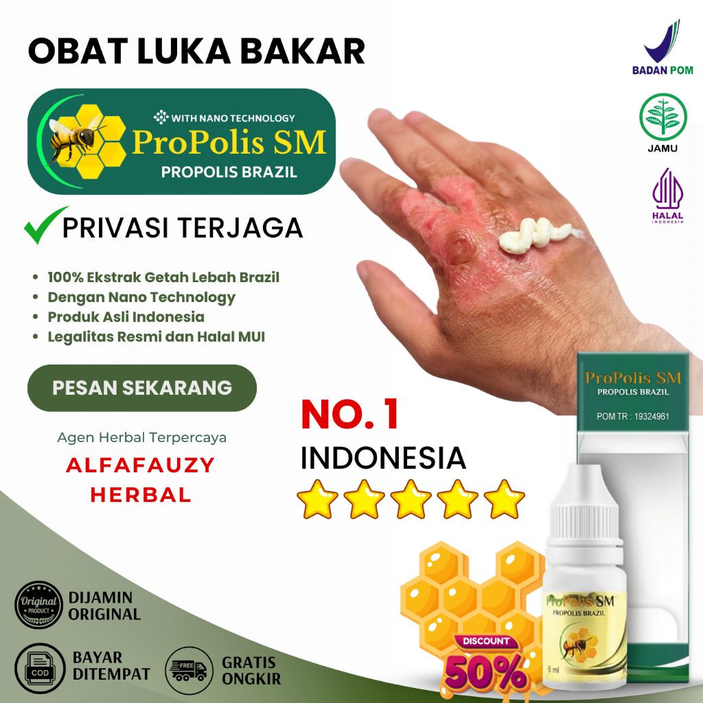 Jual Obat Oles Luka Bakar Bernanah Berair Bengkak Herbal - Propolis Sm ...