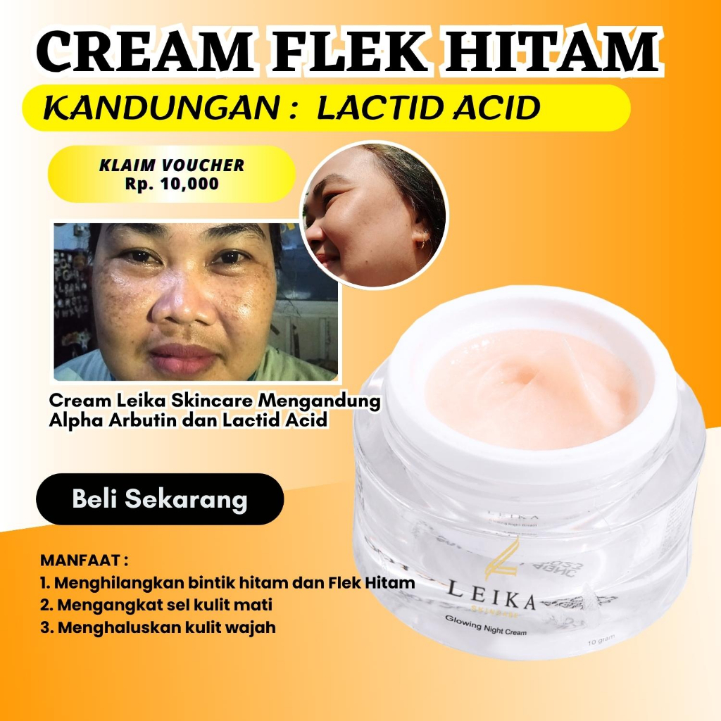 Jual HASIL SUPER CEPAT !! CREAM FLEK KRIM FLEK HITAM CREAM MALAM CREAM ...