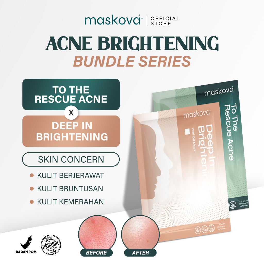 Jual Combo Masker Pencerah Wajah dan Atasi Jerawat By MASKOVA | 3X ...