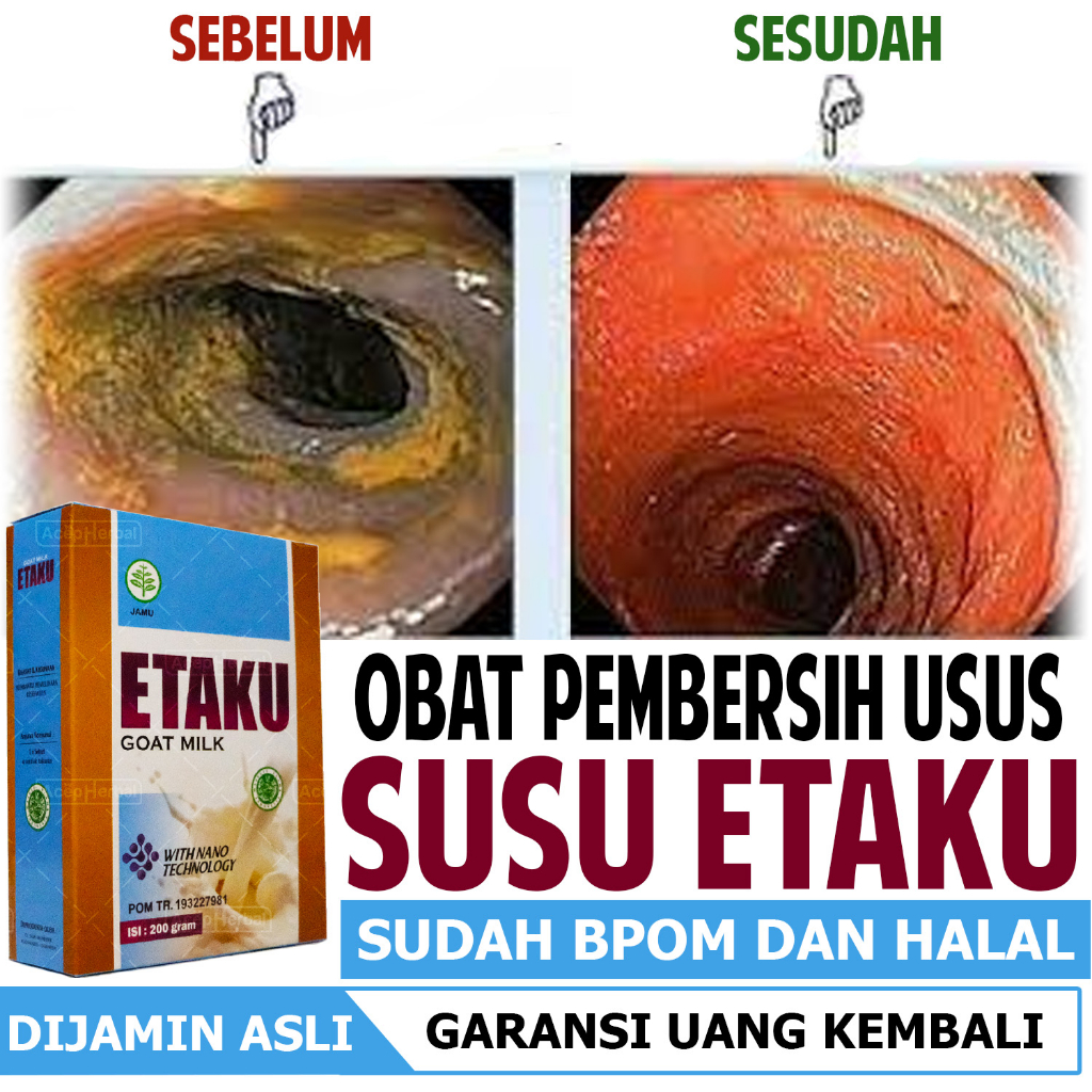 Jual Obat Pembersih Usus Kotor Detoksifikasi Radang Usus Besar Infeksi ...