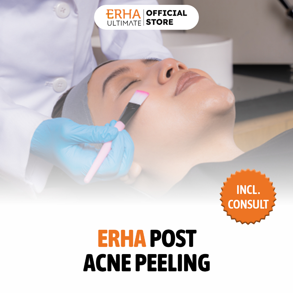 Jual ERHA Post Acne Peeling (consultation with Skin Expert) | Shopee ...