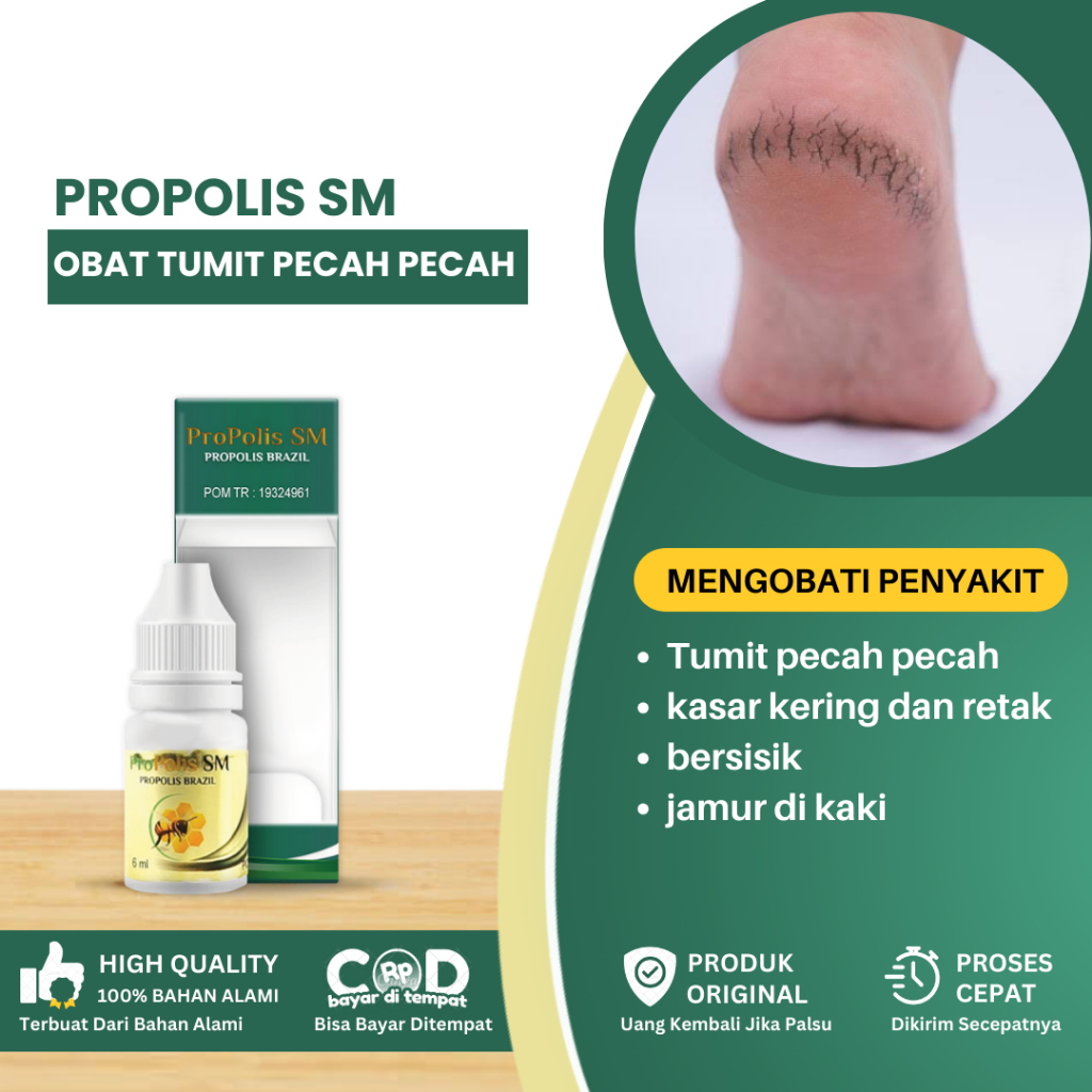 Jual Obat Tumit Pecah Pecah, Kaki Kasar Kering Dan Retak, Bersisik ...