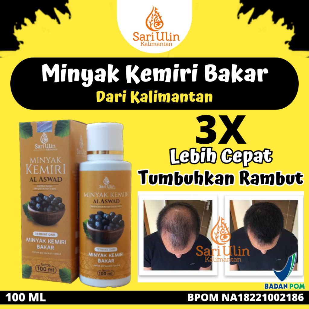 Jual Minyak Kemiri Bakar Penumbuh Rambut Anti Rontok Original 100% ...