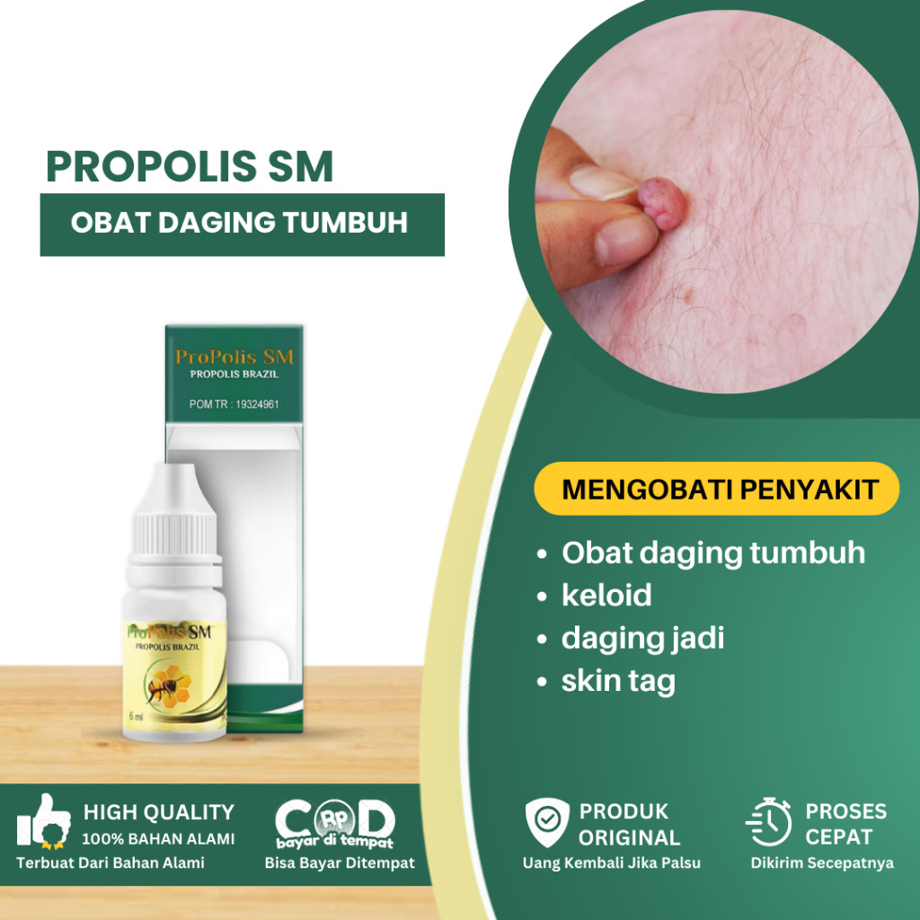 Jual Obat Daging Tumbuh Di Kulit, Daging Jadi, Obat Daging Tumbuh Pada ... Jual Obat Daging Tumbuh Di Kulit, Daging Jadi, Obat Daging Tumbuh Pada ...