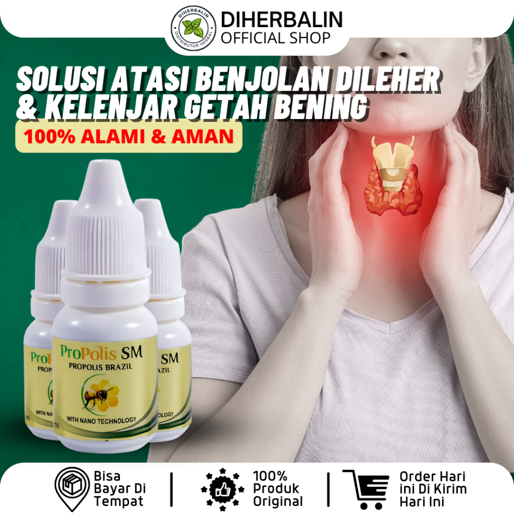 Jual ProPolis SM Obat Kelenjar Getah Bening Benjolan Di Leher Gondok ...