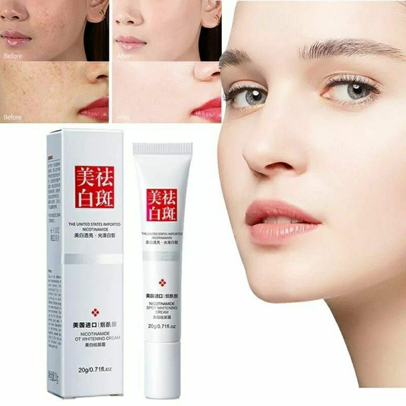 Jual cream penghilang flek hitam, mencerahkan wajah dan meringankan ...