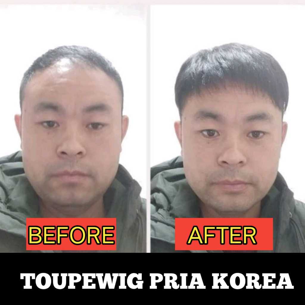 Jual Toupee pria sejati Anti Kebotakan Wig Pria Penutup Botak Rambut ...