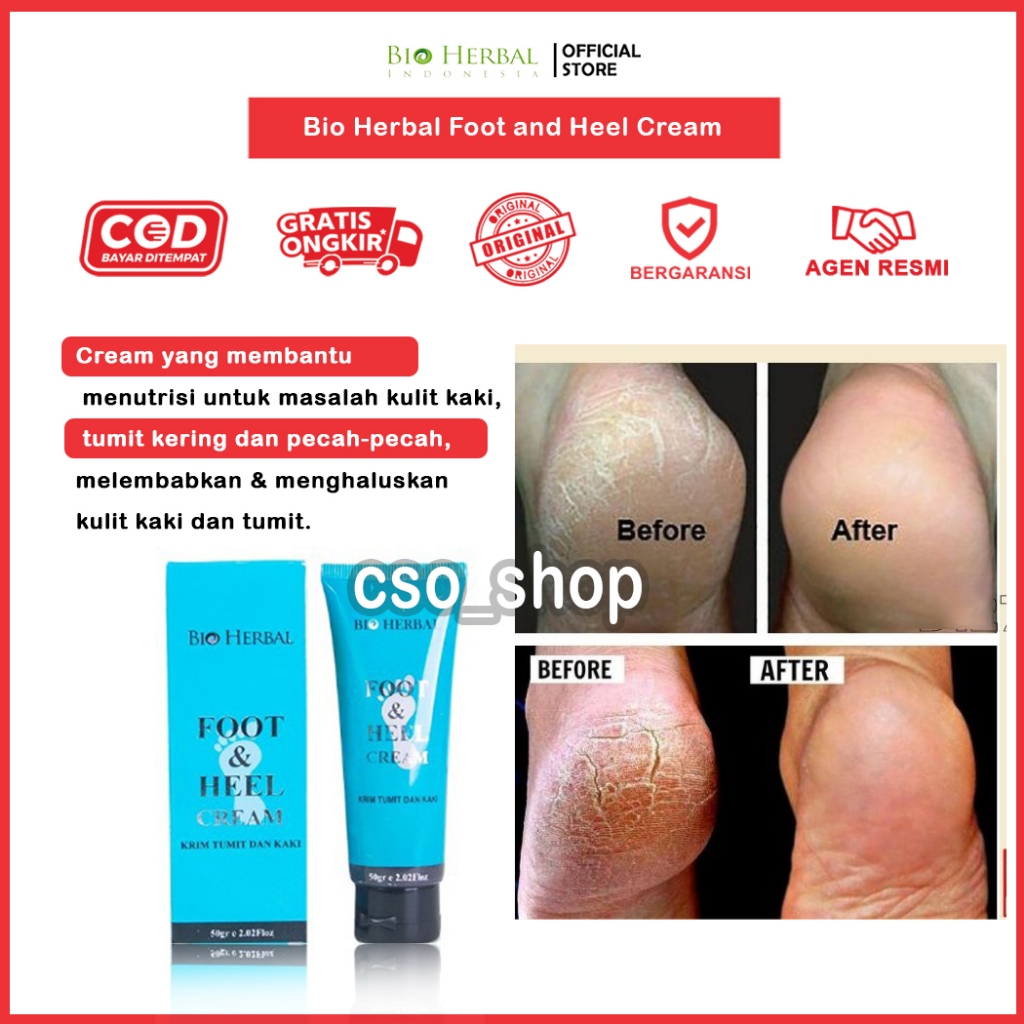Jual Bio Herbal Foot Cream Salep Tumit Kaki Pecah dan Kering Ampuh ...
