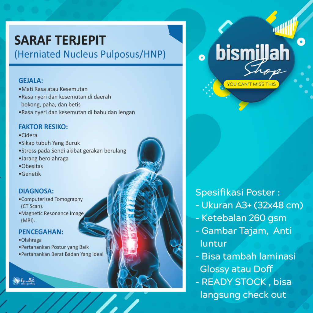 Jual Poster kesehatan saraf terjepit / HNP | Shopee Indonesia