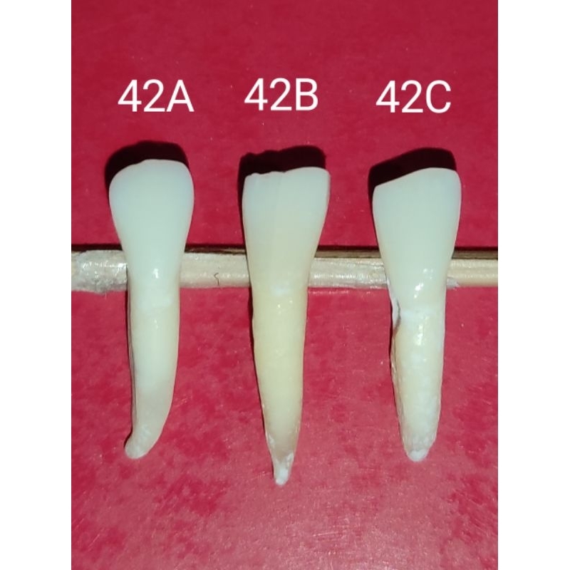 Jual Gigi Insisif Lateral Rahang Bawah Kanan (Gigi 42) - Gigi Asli ...