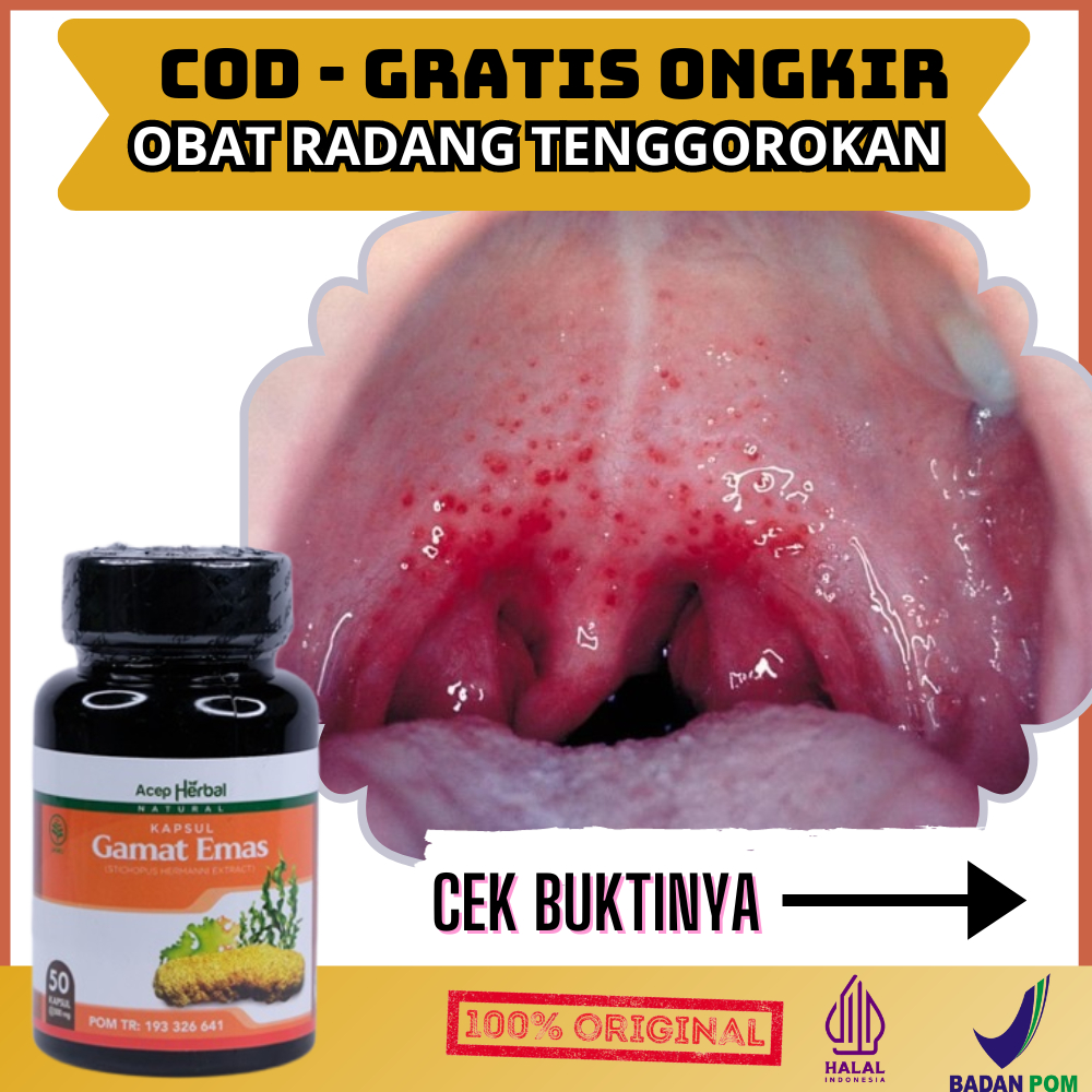Jual Obat Infeksi Tenggorokan, Obat Radang Tenggorokan, Obat Sakit ...