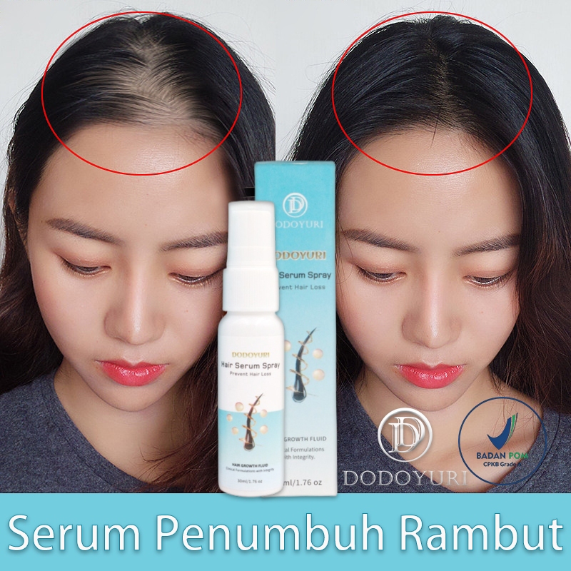 Jual (BPOM)Serum penumbuh rambut Obat penumbuh rambut Penumbuh rambut ...