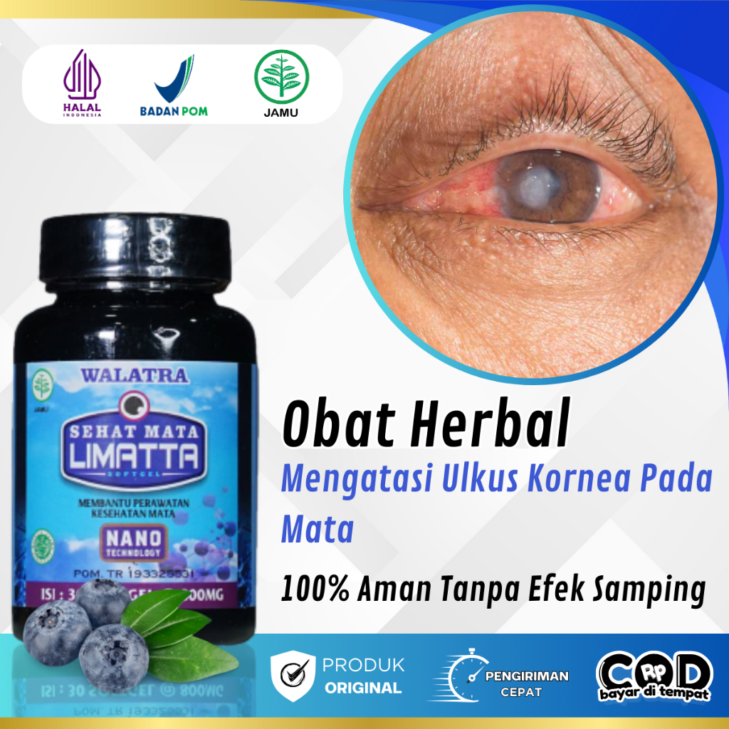 Jual Obat Ulkus Kornea Mata, Luka Kornea Mata, Tukak Ulkus Kornea Mata ...