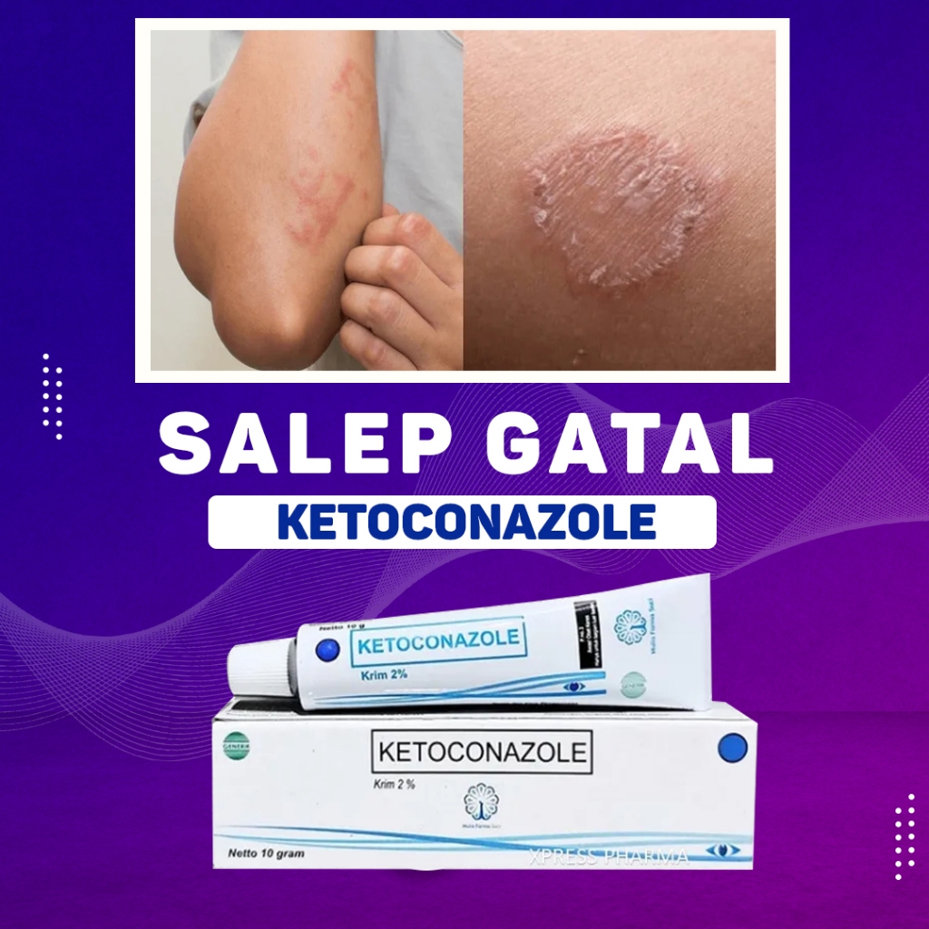 Jual KETOCONAZOLE CREAM SALEP SALEP GATAL PANU KADAS KUTU AIR EKSIM | Shopee Indonesia