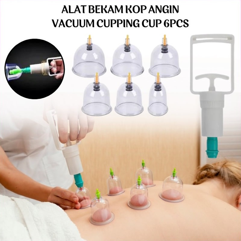 Jual Kop Angin Set Isi 6 Cup Alat Bekam Punggung Terapi Tradisional Masuk Angin | Shopee Indonesia