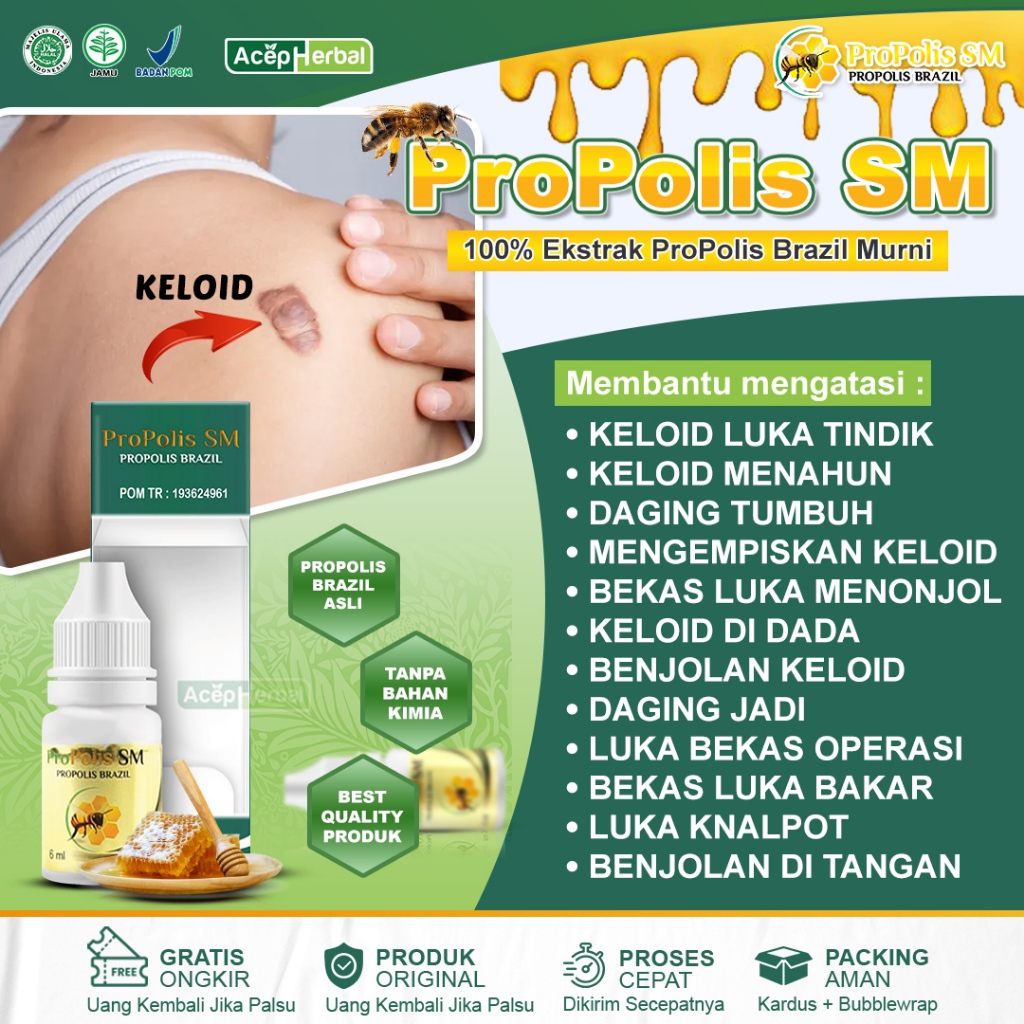 Jual Obat Keloid Daging Tumbuh Daging Jadi Penghilang Keloid Luka Tindik Di Telinga Bekas ...