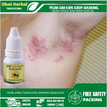 Jual Obat Ketiak Gatal, Ketiak Gatal Bintik Merah, Lipatan Ketiak Lecet ...