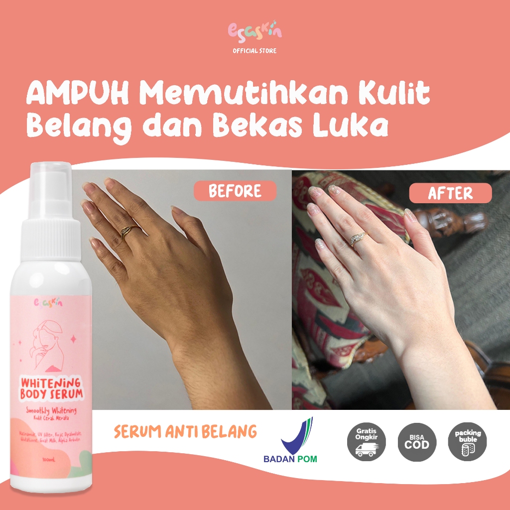 Jual ESASKIN Body Serum - Spesial Mencerahkan Kulit Area Belang ...