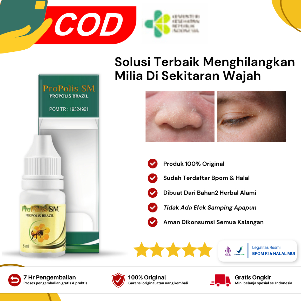 Jual Obat Penghilang Milia Di Bawah Mata Pada wajah Di Kelopak Mata ...