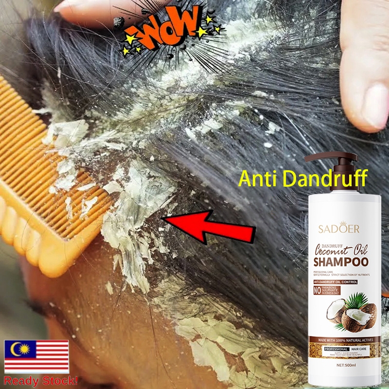 Jual Sampo anti ketombe Sampo ketombe Shampo kutu rambut 500ML obat ketombe rambut Minyak Asam ...